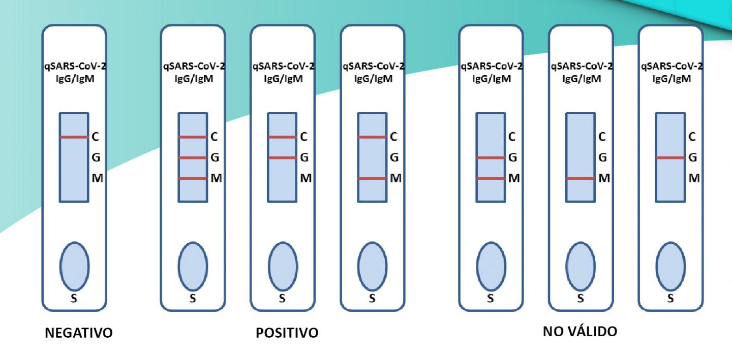 Test Rápido COVID 19 qSARS-CoV-2 IgG/IgM | PALEX MEDICAL S.A. Test Rápido COVID 19 qSARS-CoV-2 IgG/IgM | PALEX MEDICAL S.A.
